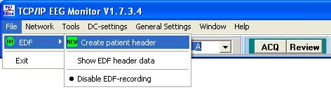 EEG-Monitor with EDF registration